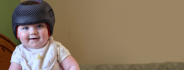 The Evaluation and Management of Infant Head Shape Abnormalities – CEEI