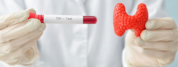 Thyroid Function Testing and Thyroid Nodules – CEEI