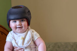 The Evaluation and Management of Infant Head Shape Abnormalities (35 ...